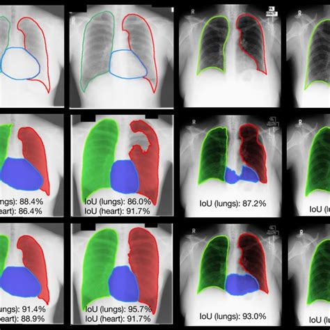 important contour landmarks around lung fields aortic arch 1 is download scientific diagram