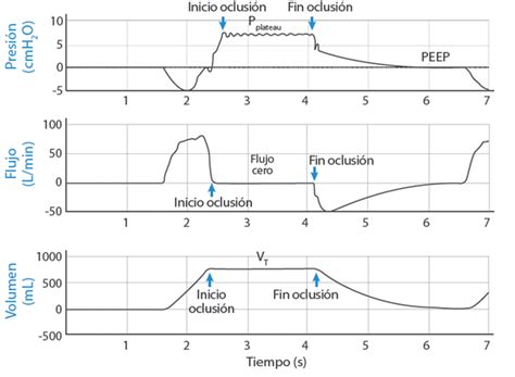 Curvas de presión flujo y volumen medidos por el ventilador Hamilton