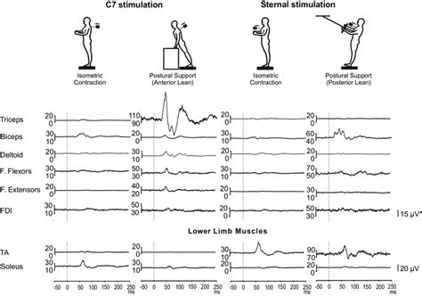 upper and lower limb emg responses to axial impulses delivered during download scientific