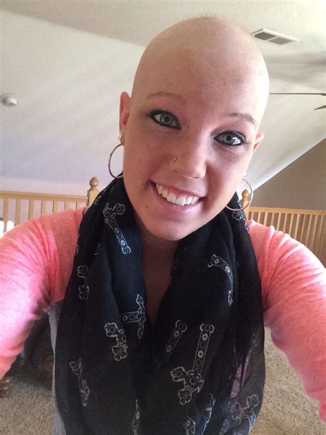 Alopecia Changed My Life Super Short Hair Short Hair Cuts Short Hair