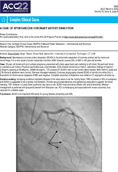 A Case Of Spontaneous Coronary Artery Dissection Journal Of The