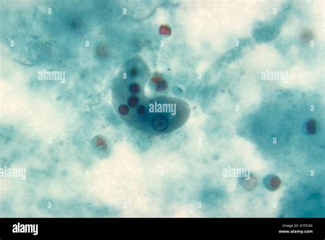 Entamoeba Histolytica Hi Res Stock Photography And Images Alamy