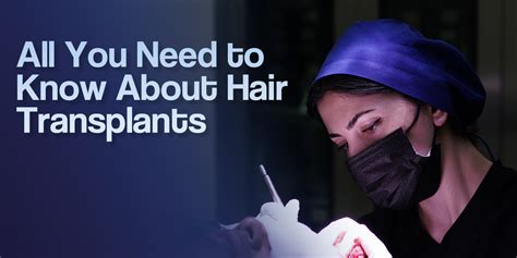 Hair Transplant Life All You Need To Know About Hair Transplants