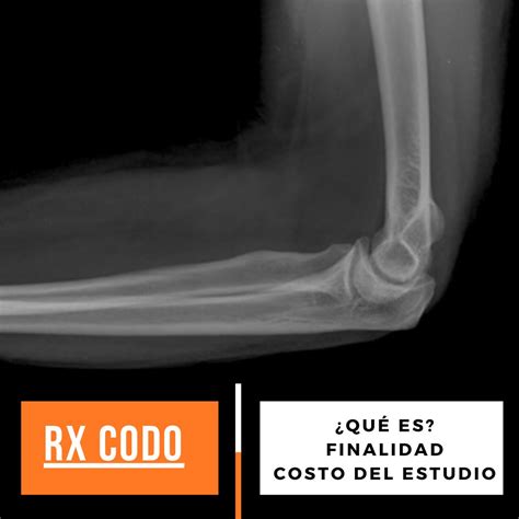 Radiograf A Del Codo