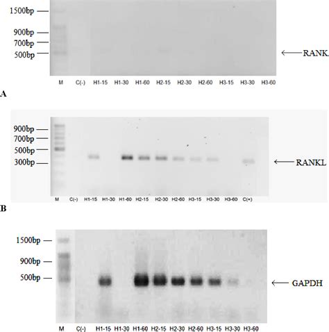 Figure 9 From The Regulation Of RANK And RANKL MRNA Expression Through
