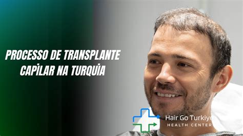 Processo De Transplante Capilar Na Turquia YouTube