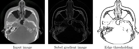 figure 2 1 from medical image segmentation using gpu accelerated variational level set methods
