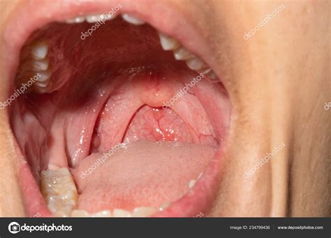 Open Throat