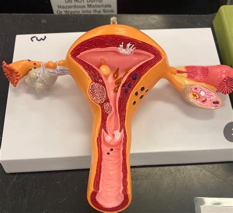 Uterus Ovary Common Pathologies Diagram Quizlet