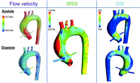 the computational fluid dynamics analysis in healthy control case 1 download scientific