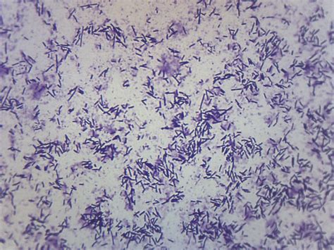 E Coli Under Microscope Gram Stain Micropedia