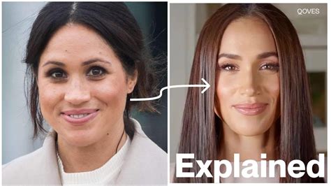 Meghan Markle S New Face Explained YouTube