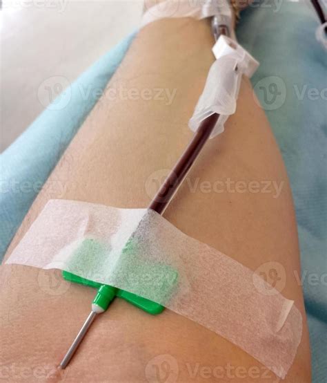 agulha no braço do doador de sangue durante a doação de sangue It Hurts