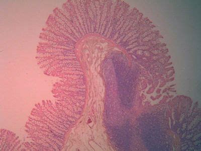 Large Intestine Histology Large Intestine Histology Slide
