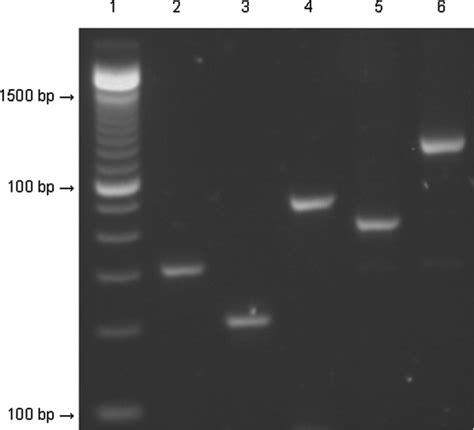 representative multi locus variable number tandem repeat analysis download scientific diagram