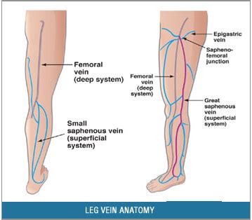 Varicose Veins Removal St Louis Laser Lipo And Vein Center