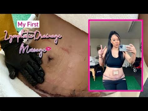 Tummy Tuck Vlog Post Op Week 1 Lymphatic Drainage Massage YouTube