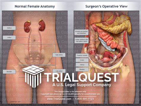 Normal Female Anatomy Vs Surgeon S Operative View TrialQuest In