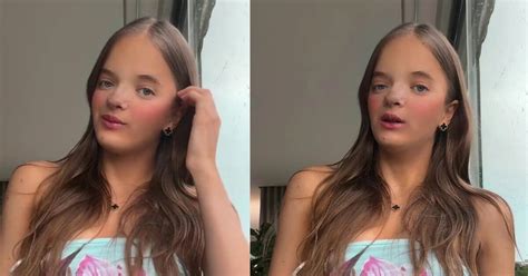 Pode Fazer Rinoplastia Anos Cirurgia No Nariz De Rafa Justus