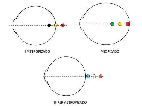 Pautas para el examen subjetivo El éxito afinar Vision y Óptica
