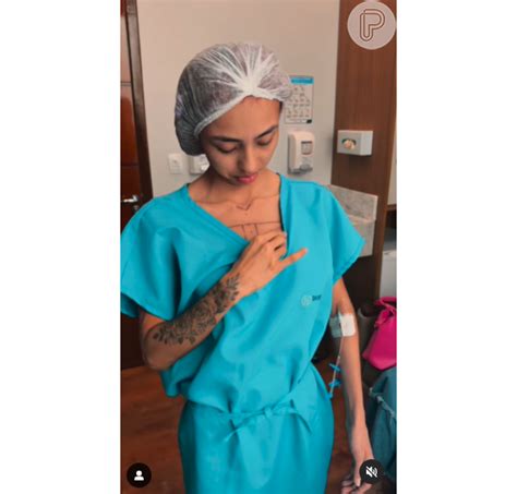 Ruivinha De Marte Antes E Depois De Colocar Deixa Internautas De Queixo