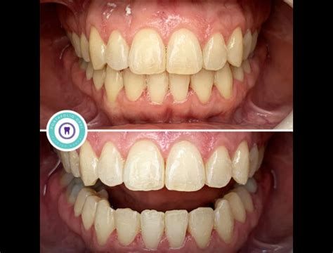 Ortodoncia y Ortopedia Dentomaxilar Portafolio Oral Clínica Dental