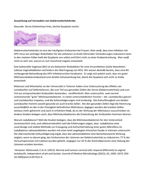 Auswirkung auf Vorstadien von Gebärmutterhalskrebs