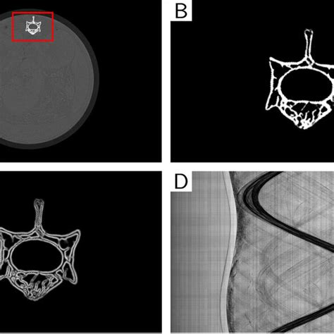 pdf statistical iterative reconstruction algorithm for x ray phase contrast ct