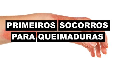 O Que Fazer Em Caso De Queimaduras Primeiros Socorros YouTube