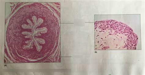 Ureter Cross Section Diagram Quizlet
