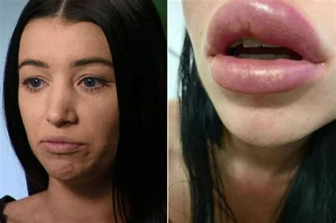 Barbie Wannabe 19 Spends 14k A Year On Surgery To Look Like