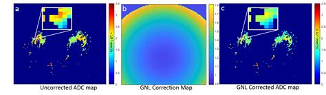 gradient nonlinearity gnl correction for adcs of 81 breastlesions in the a6702 multicenter