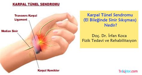 Karpal Tünel Sendromu El Bileğinde Sinir Sıkışması Nedir Makale