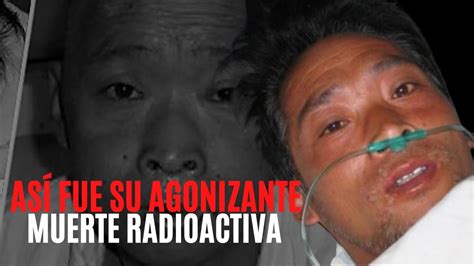 El lento y cruel final del hombre más radioactivo del mundo YouTube