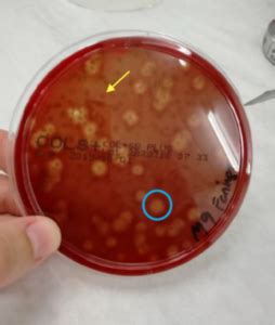 Hemólisis Alfa En Agar Sangre