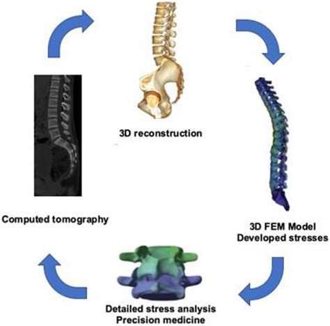 jfb free full text finite element method for the evaluation of the human spine a literature