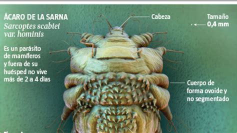 Qu Es La Sarna O Escabiosis Sntomas De La Sarna
