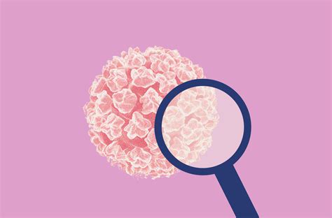 Hpv Conhe A Sintomas Formas De Transmiss O E Tratamentos