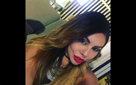 Foto Liziane Gutierrez de A Fazenda detalha harmonização facial que