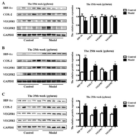 Protein expression levelsof COX 2 HIF 1α VEGF and VEGFR1 in the