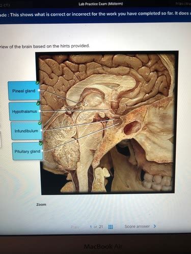 Anatomy And Physiology Lab Exam Midterm Flashcards Quizlet