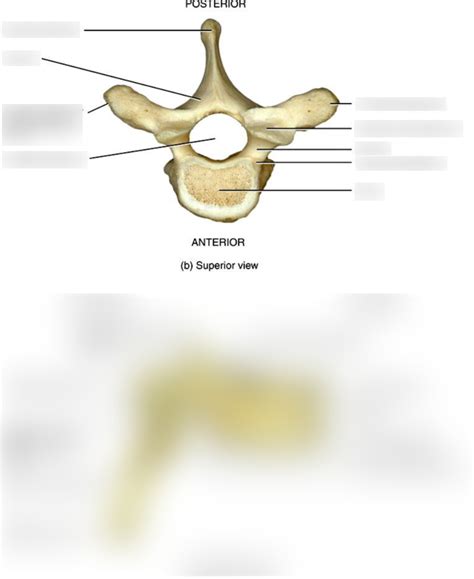 Thoracic Vertebra Superior View Diagram Quizlet