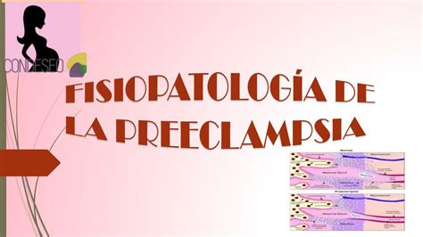 Fisiopatología de la Preeclampsia JENNY PELTROCHE uDocz