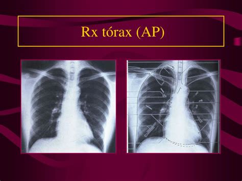 PPT Anatomia radiológica PowerPoint Presentation free download ID