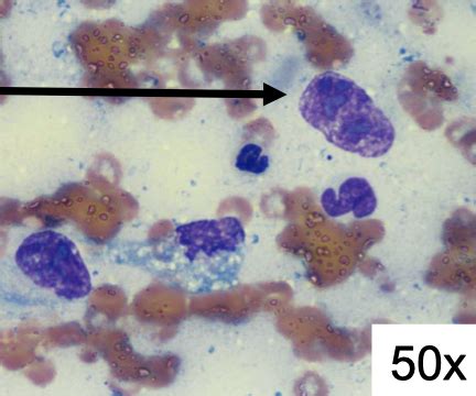 Clin Path Cytology Effusions Histo Flashcards Quizlet