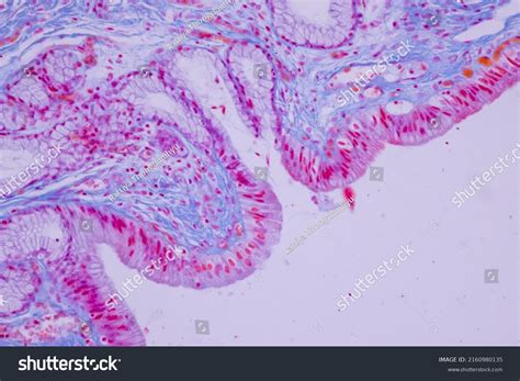 Columnar Epithelium Human Gall Bladder Under Stock Photo