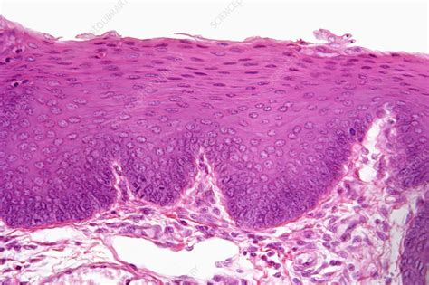 Stratified Squamous Epithelium LM Stock Image C005 5901 Science