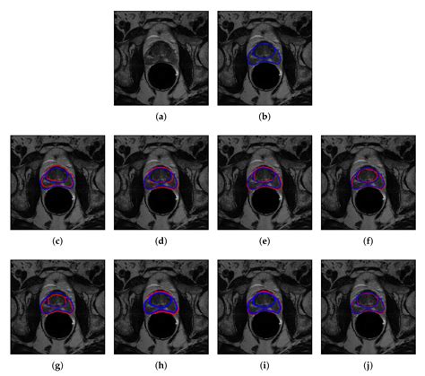sensors free full text evaluation of deep neural networks for semantic segmentation of
