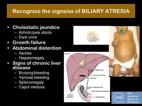 PPT Pediatric Liver Disease PowerPoint Presentation ID 3804403