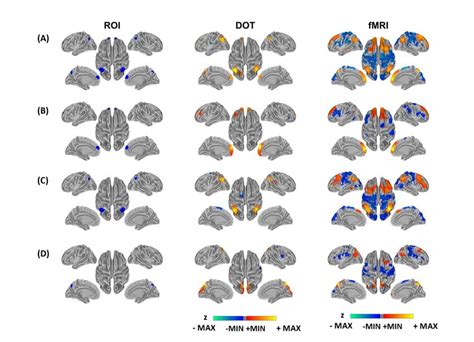 resting state functional connectivity by fnirs hbr and fmri download scientific diagram